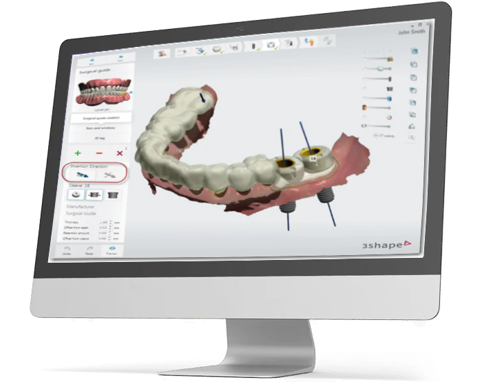 دوره آموزش Surgical Guide | سرجیکال گاید - آریو سلامت