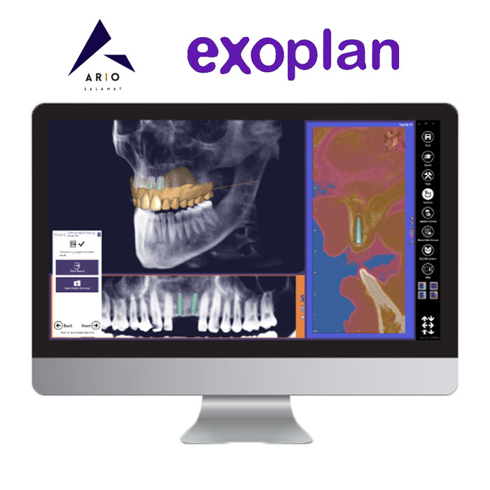 دانلود نرم افزار Exoplan | اگزوپلن اورجینال - آریو سلامت